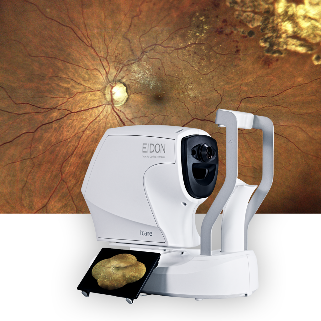 iCare EIDON Ultra-Widefield Retinal Imaging