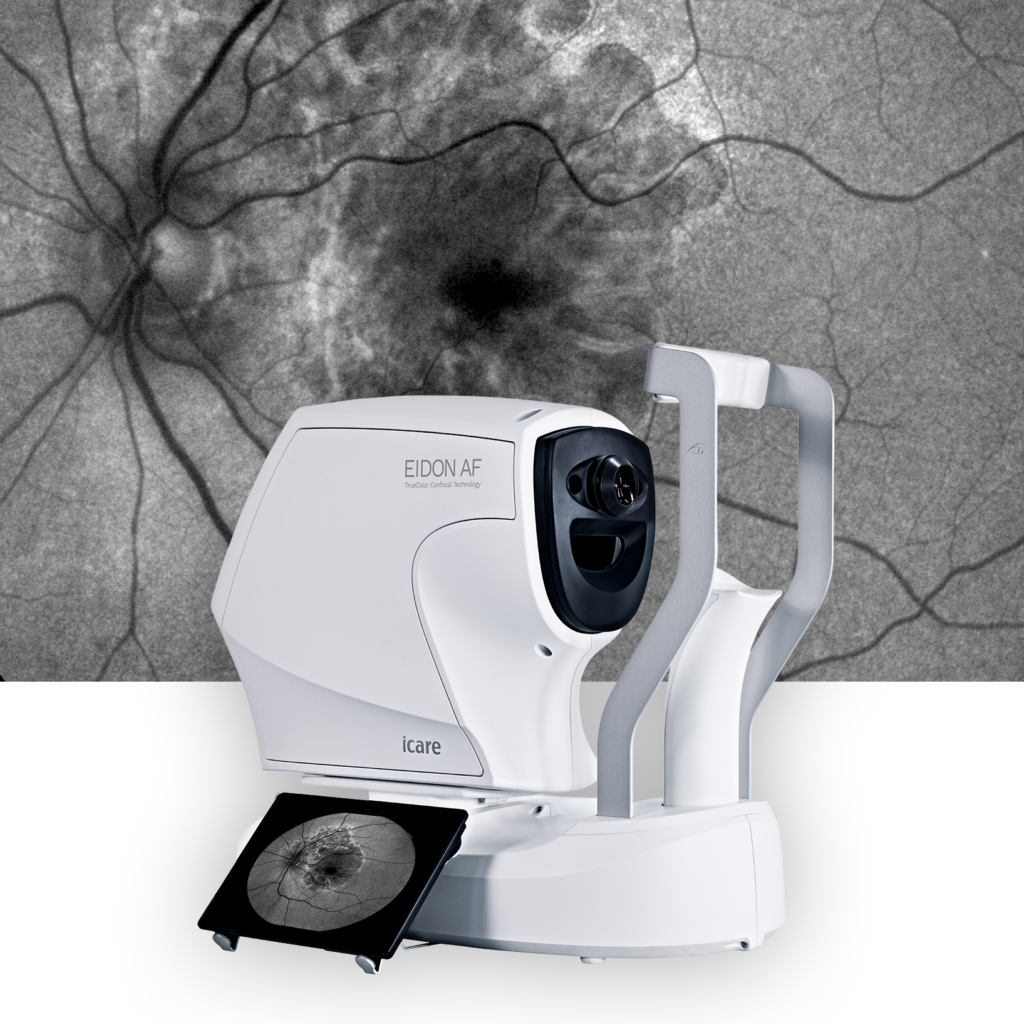 iCare EIDON AF retinal imaging with Autofluorescence