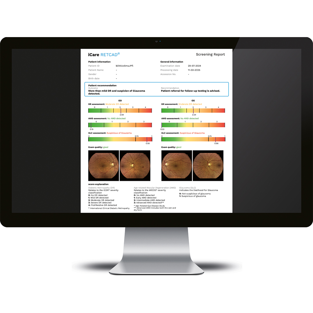 Large-scale screening programs for eye health - iCare